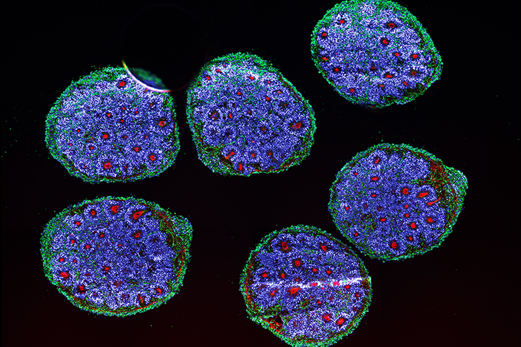 Organoids: Your Organs in One Dish – MD Notes